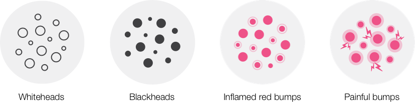 Your personal clear-skin regimen | Walgreens